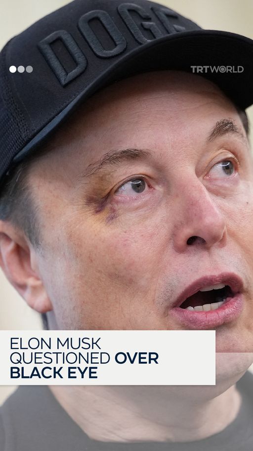 Elon Musk shows up with black eye in Oval Office send-off - TRT World