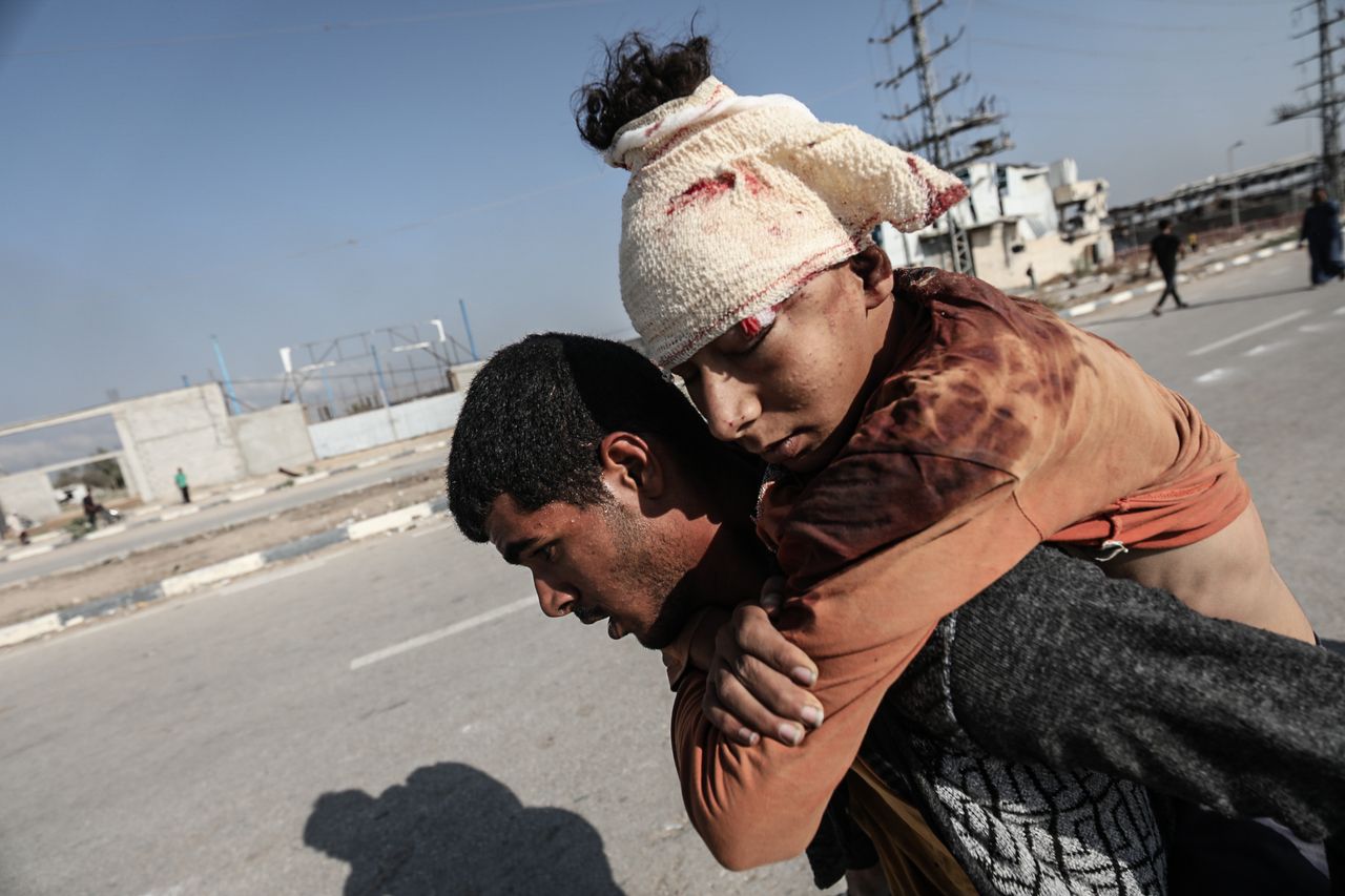 Foreign doctors in Gaza describe worst wounds 'they've ever seen' - TRT ...
